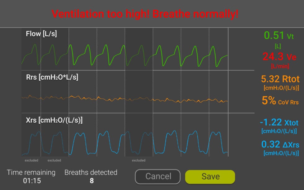 How do you perform an oscillometry test - Restech